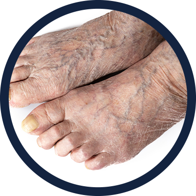 Vein Specialists of New Mexico